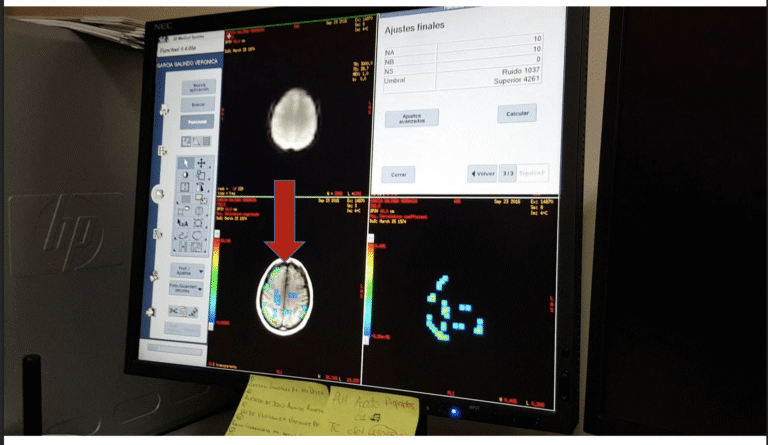 New Research Validates the Butterfly Hug as a Evidence-Based Trauma ...